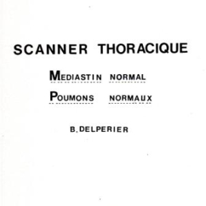 Guide d'interprétation de scanner thoracique - Conservatoire du ...